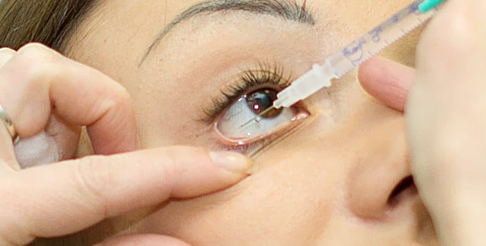 Avastin St Augustine Trinidad West Indies Precision Cataract Surgery Avastin St Augustine Trinidad West Indies Precision Cataract Surgery
